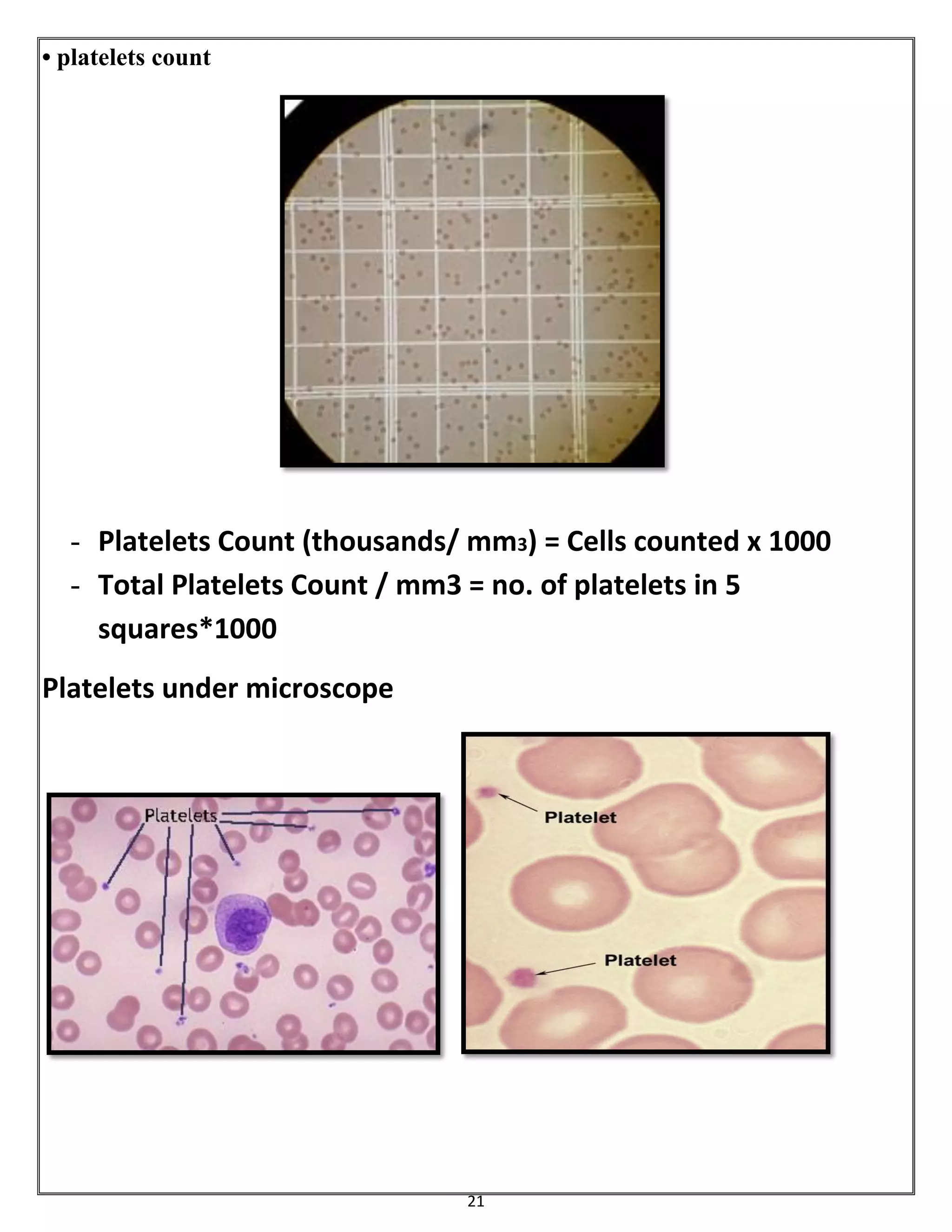 Urine analysis & Hematology Slides | PDF