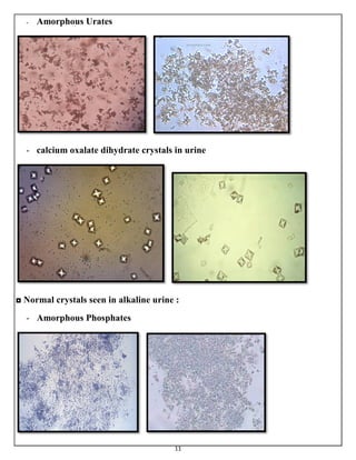 Urine analysis & Hematology Slides | PDF