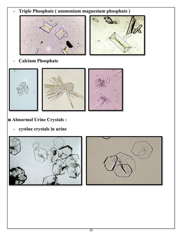 Urine analysis & Hematology Slides | PDF | Blood Disorders | Diseases ...