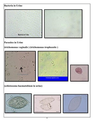 Urine analysis & Hematology Slides | PDF