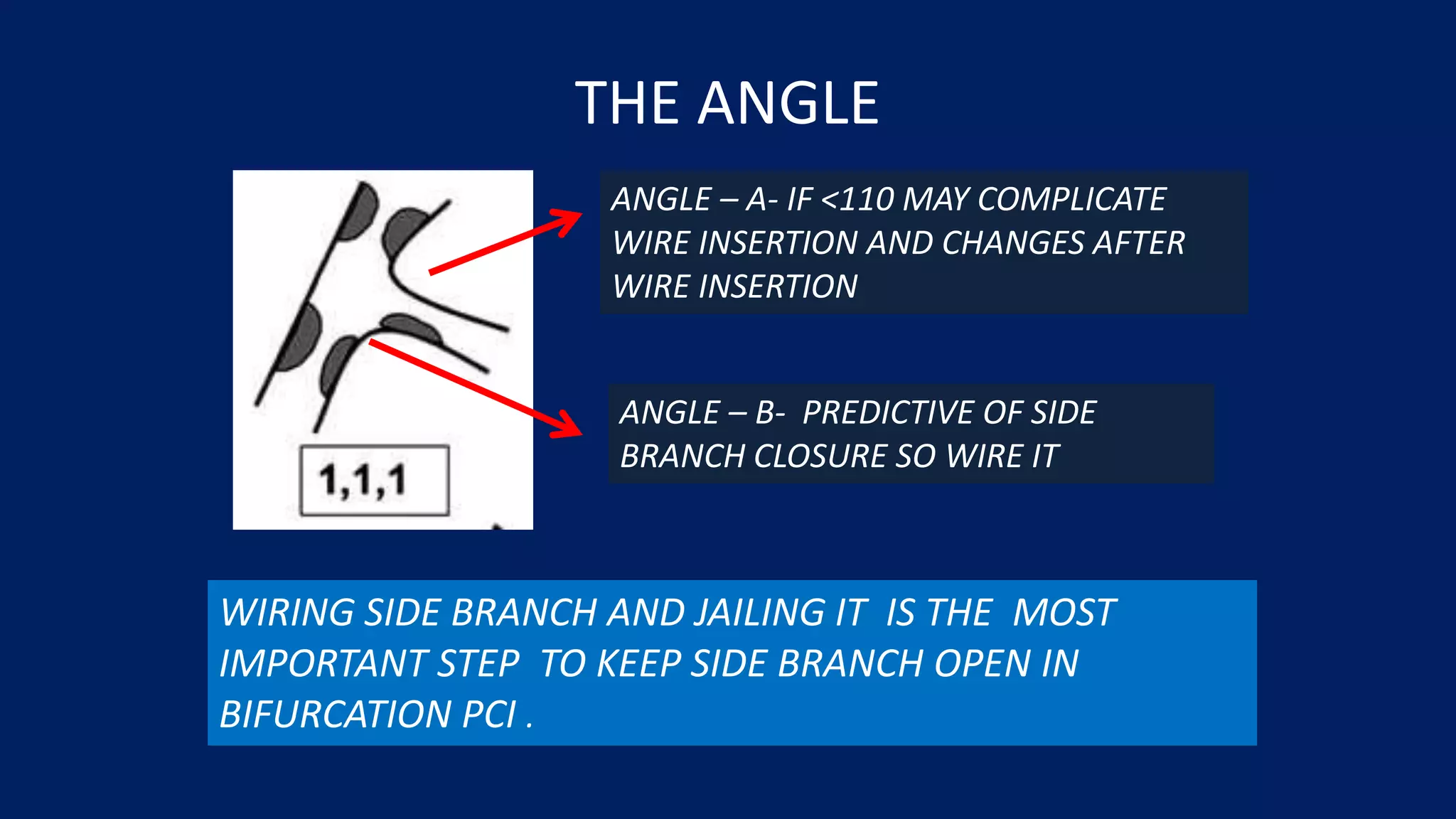 Side branch stenosis.pptx
