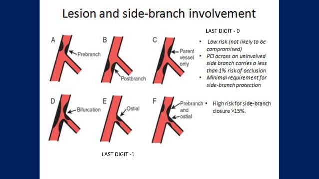 Side branch stenosis.pptx | Free Download