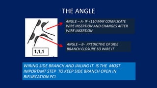 Side branch stenosis.pptx