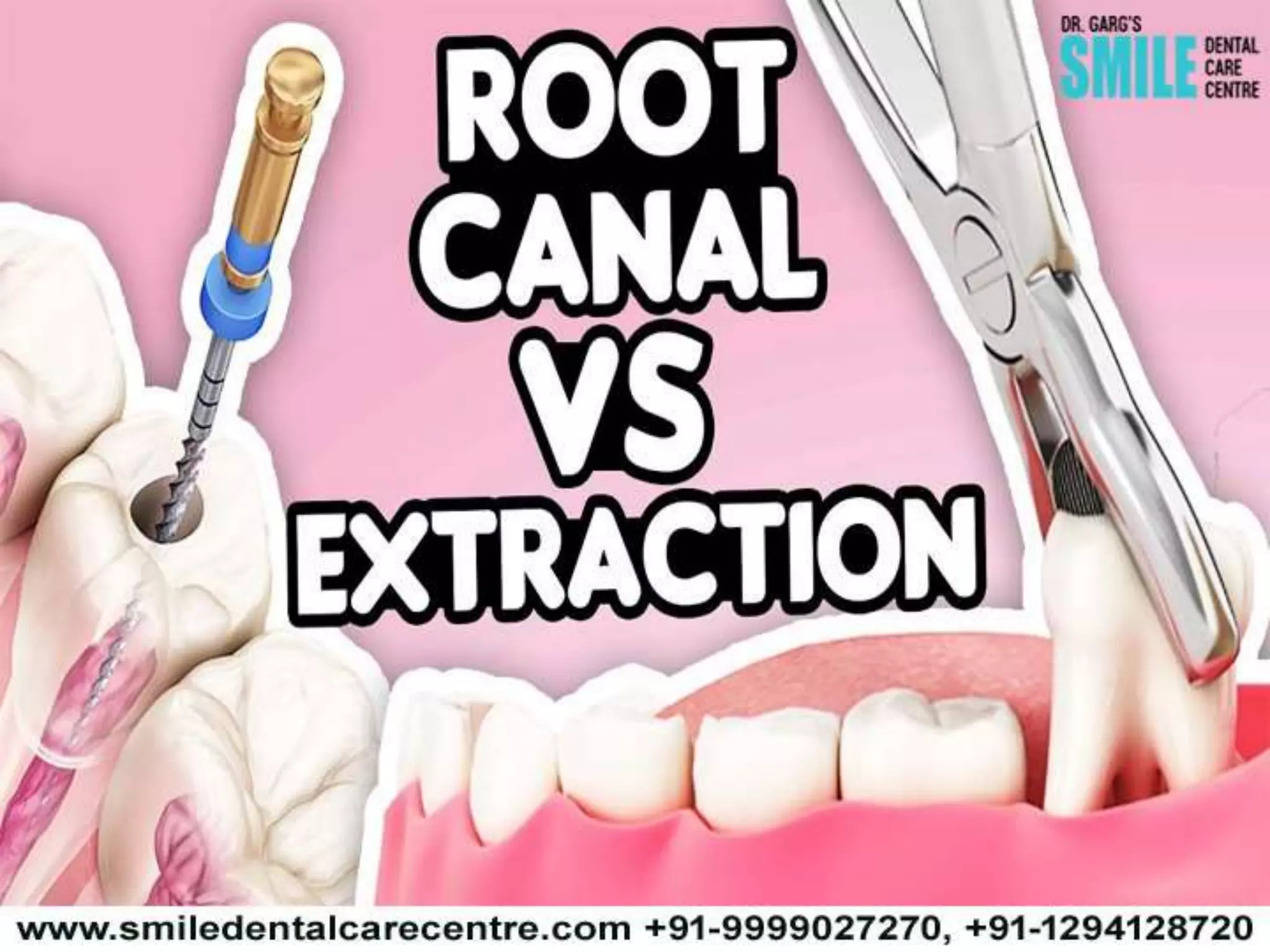 What Are The Side Effect And Dangers of Root Canal Treatment? | PPTX
