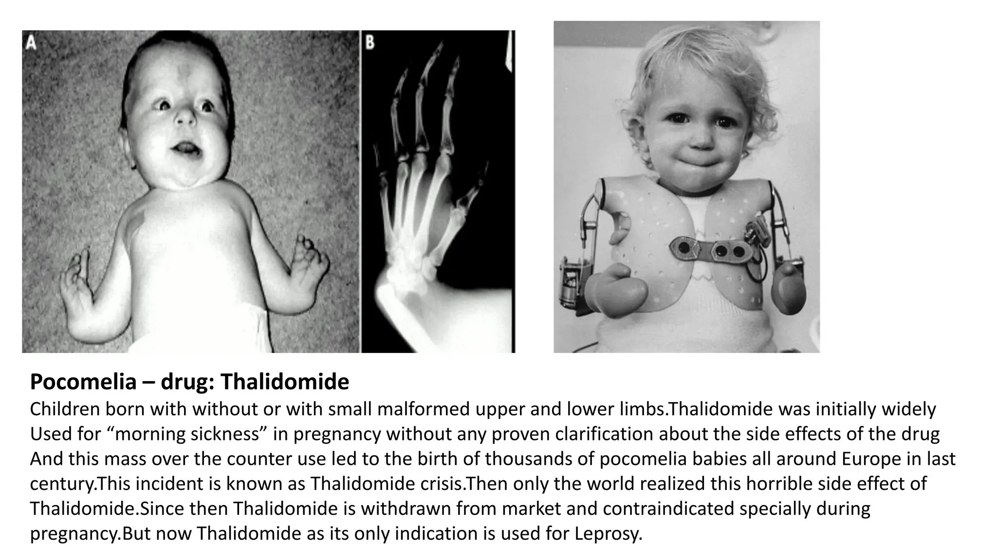 Pharmacology OSCE guide (Side effects of drugs).pdf