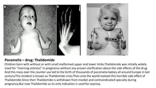 Pharmacology OSCE guide (Side effects of drugs).pdf