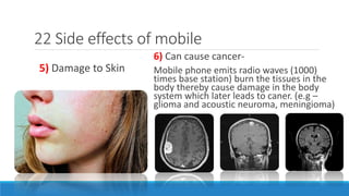 Mobile side effect on human body | PPTX