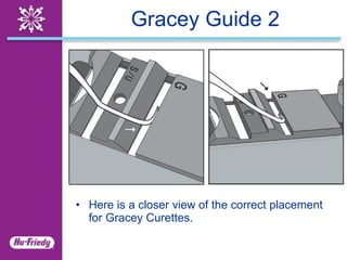 Sidekick Sharpener | PPT