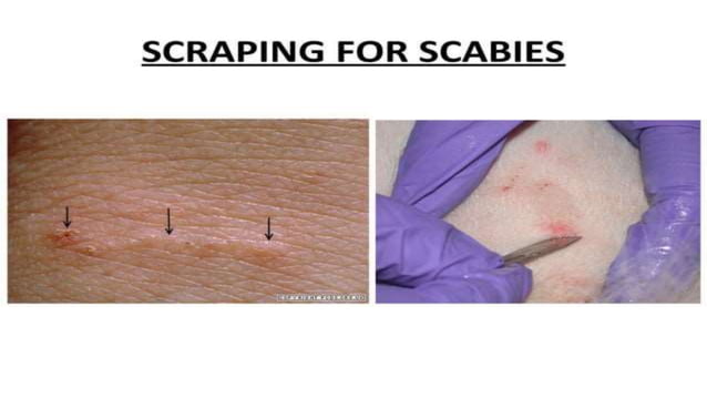 SIDE LAB INVESTIGATIONS IN DERMATOLOGY srt-1.pptx | Skin and ...