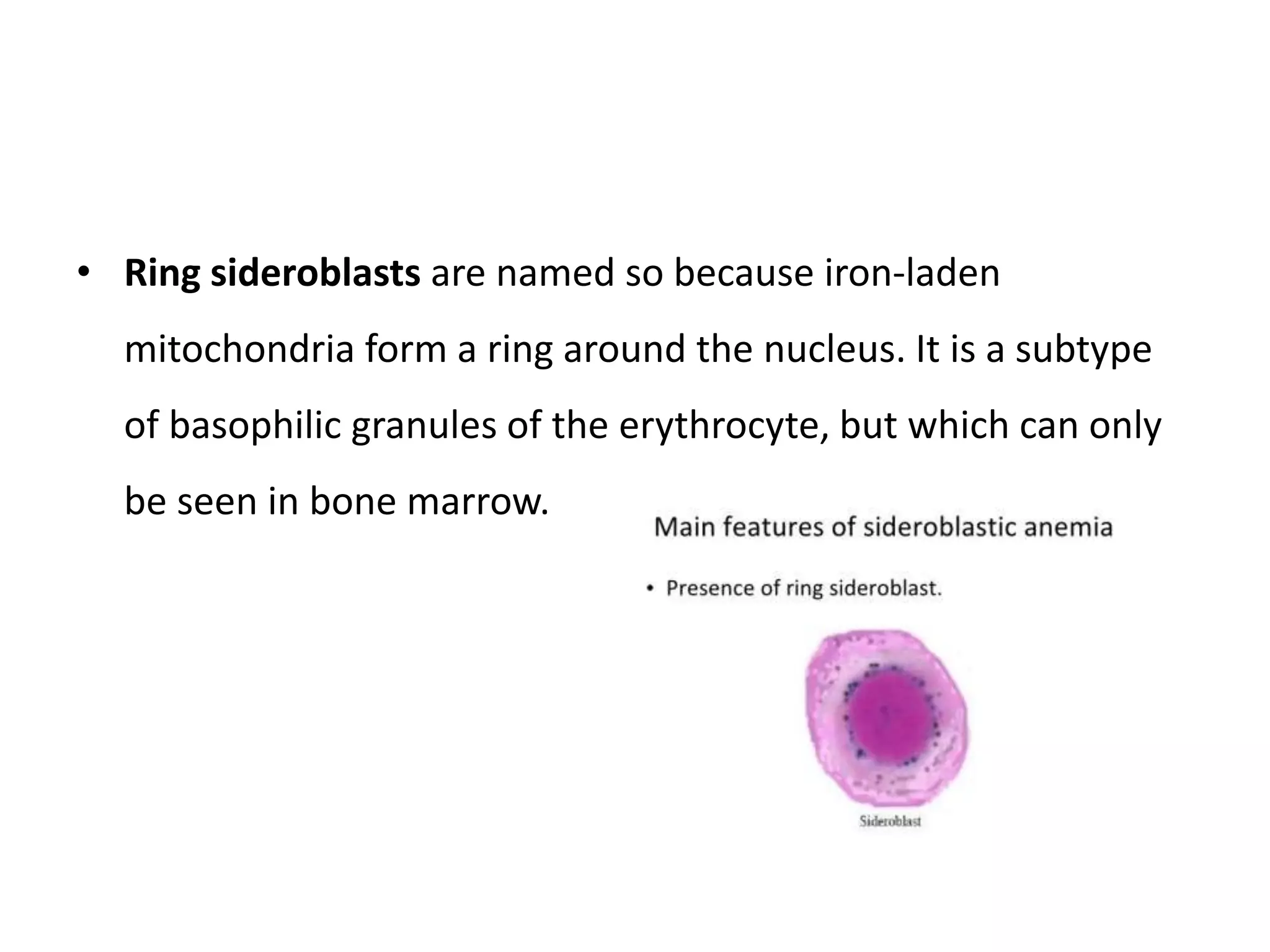 Sideroblastic anemia - Etiopathogenesis, Clinical features, Advances in ...