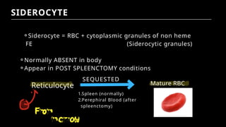 Sideroblastic anemia (kartik chande 24044).pptx
