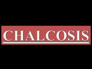 Siderosis &chalcosis & IOFB | PPTX