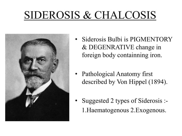 Siderosis &chalcosis & IOFB | PPTX | Eye and Vision Conditions ...