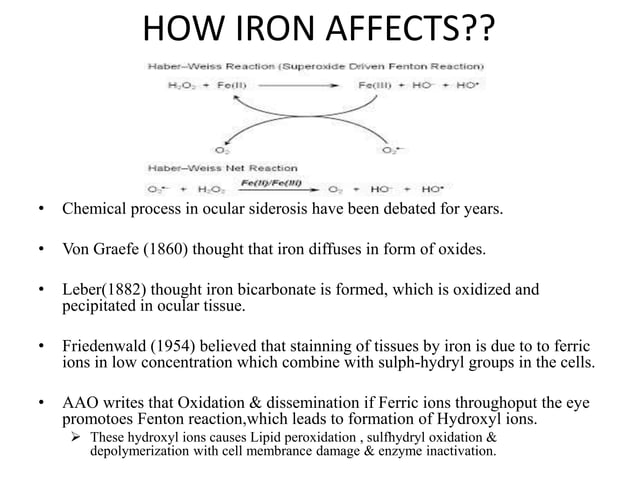 Siderosis &chalcosis & IOFB | PPTX | Eye and Vision Conditions ...