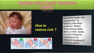 SIDS | PPT