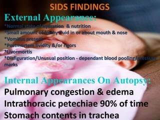 Sids ruben copy | PPT