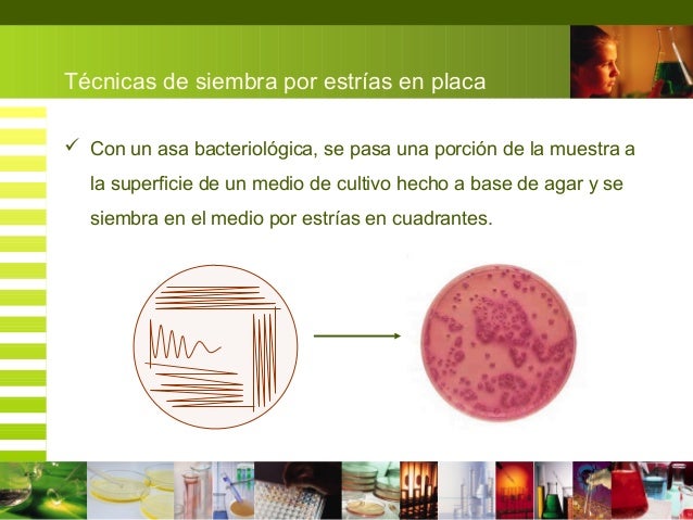 Técnicas de Aislamiento y Estriado