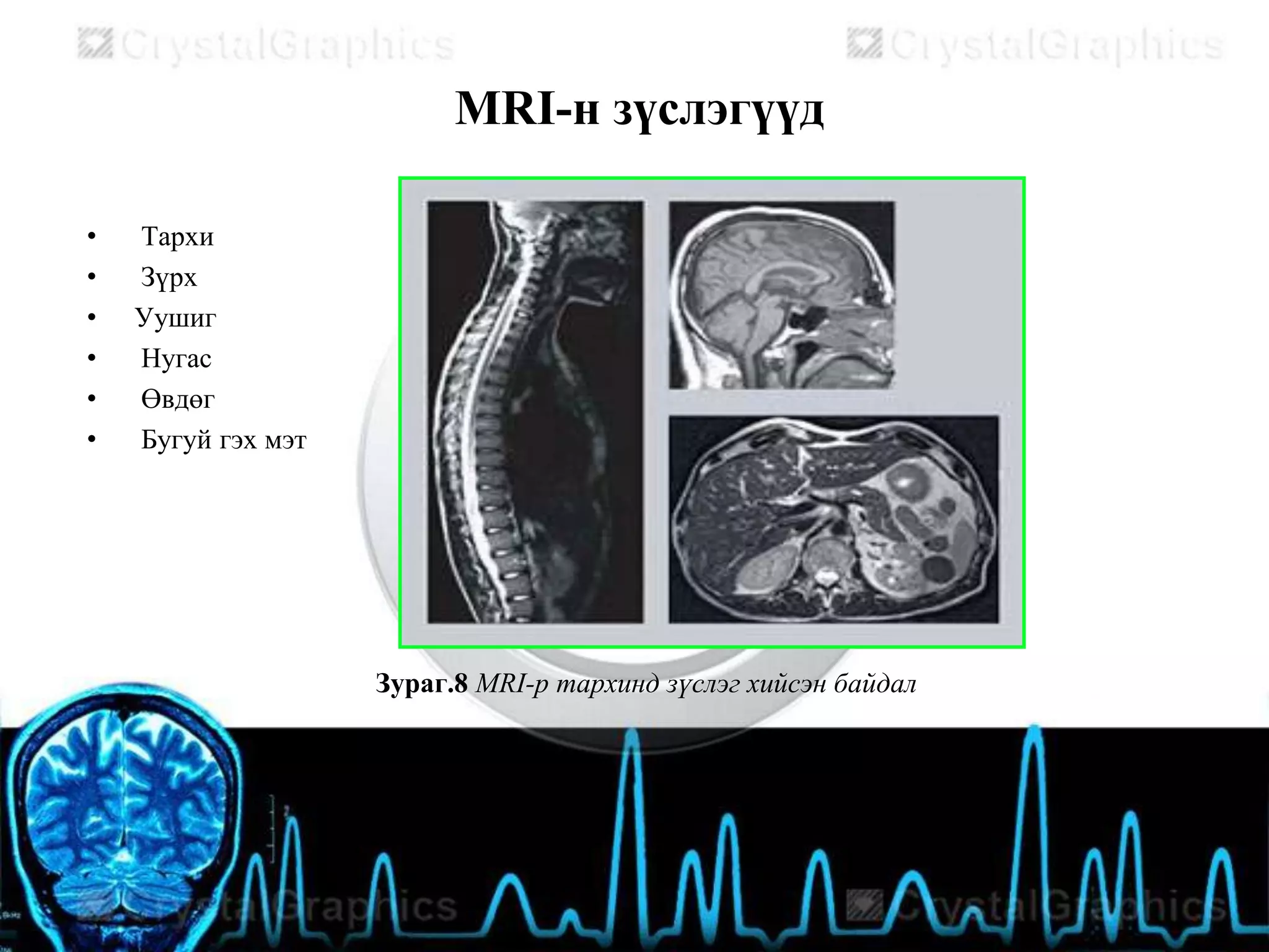 Inomed-2013 Huree ict Naranbaatar | PPTX