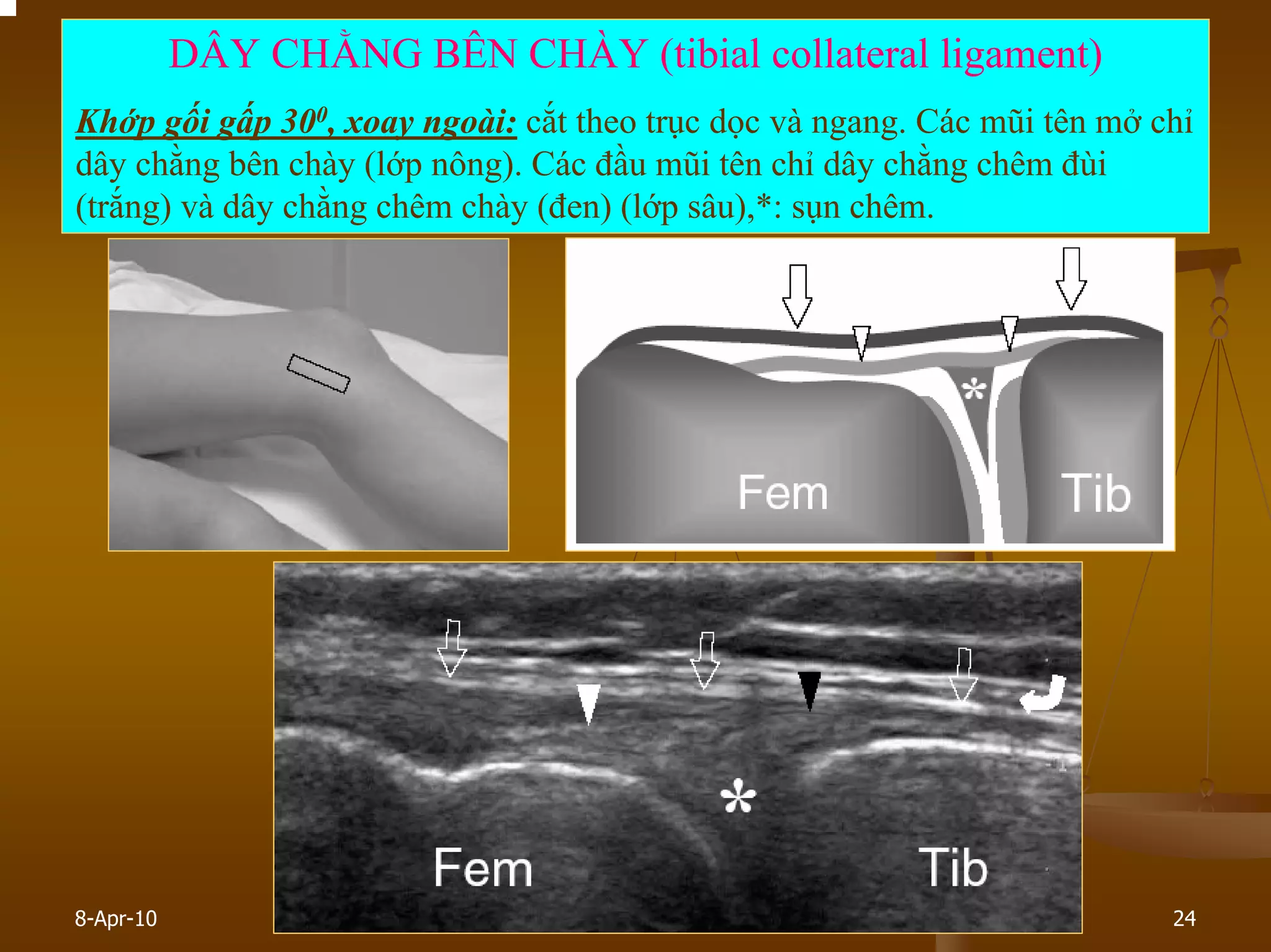 Sieu am khop goi | PDF