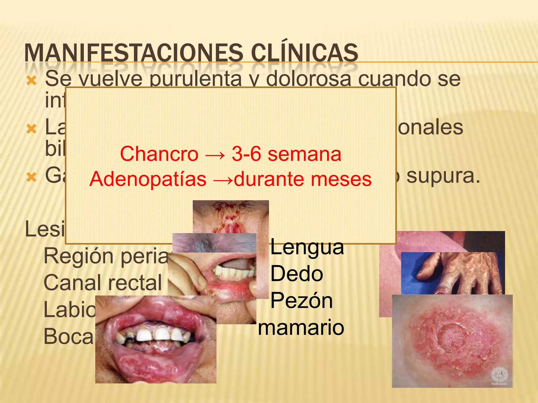Sifilis | PPT
