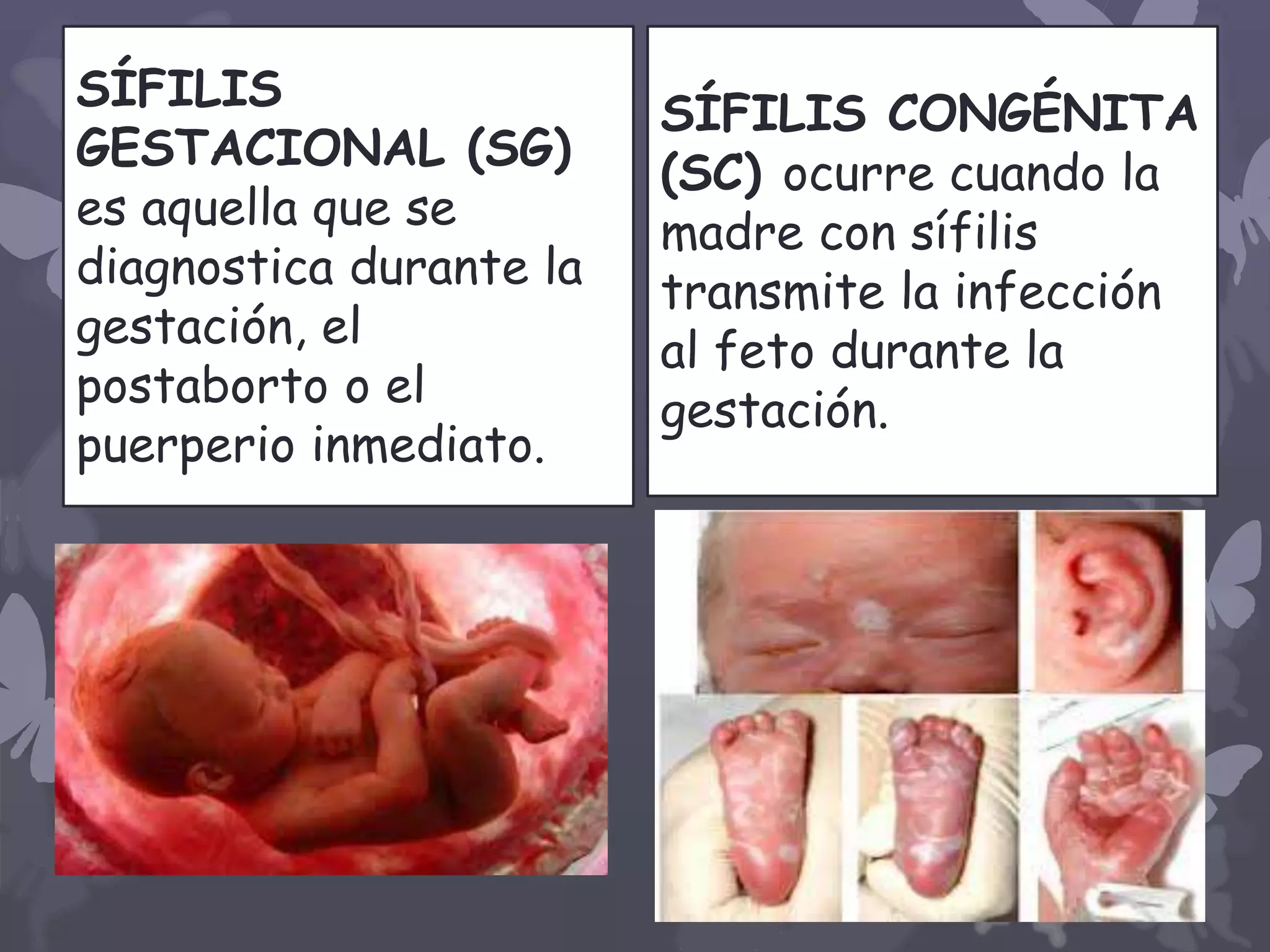 Sifilis | PPTX