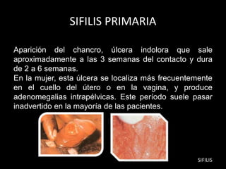 Sifilis | PPTX