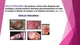 Sifilis | PPTX