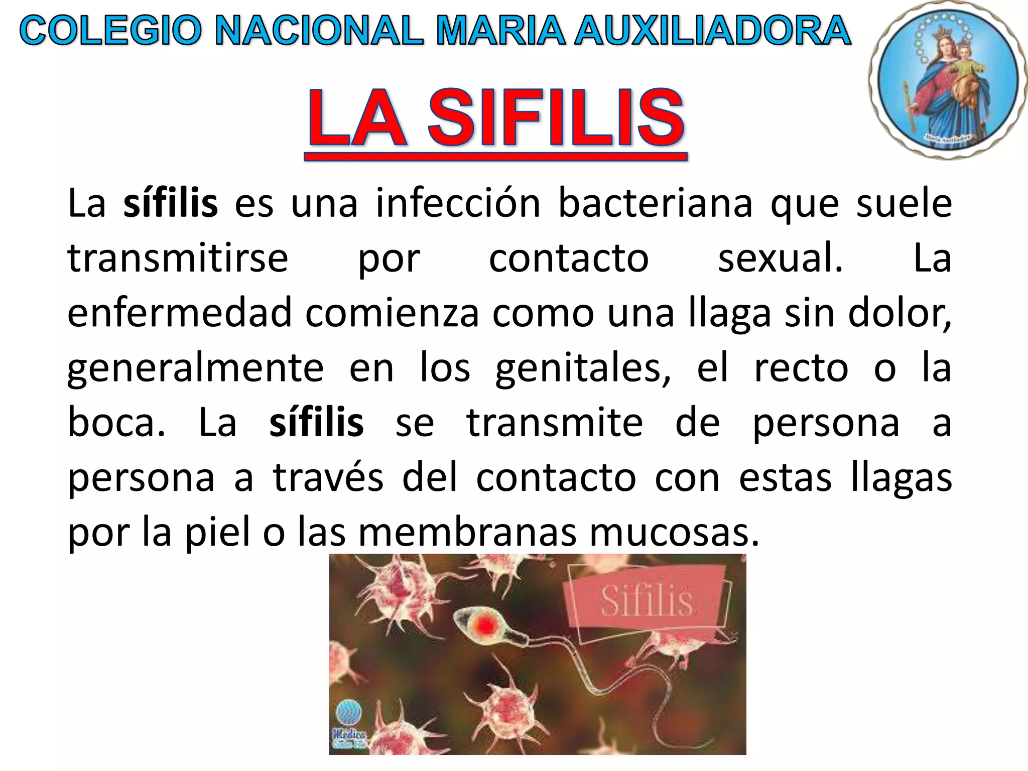 SIFILIS.pptx