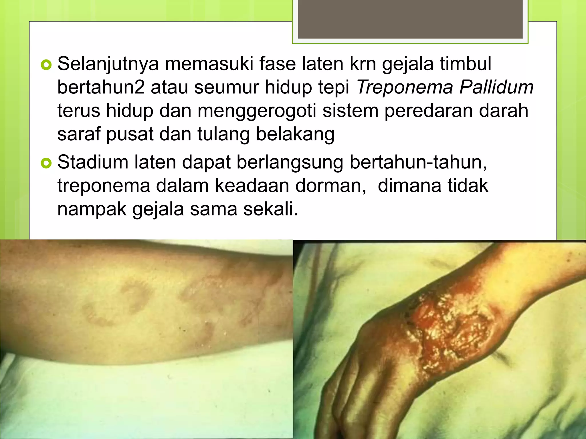 sifilis.pptx