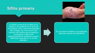 sifilis. expo PARA DOCTORA NORMA.pptx
