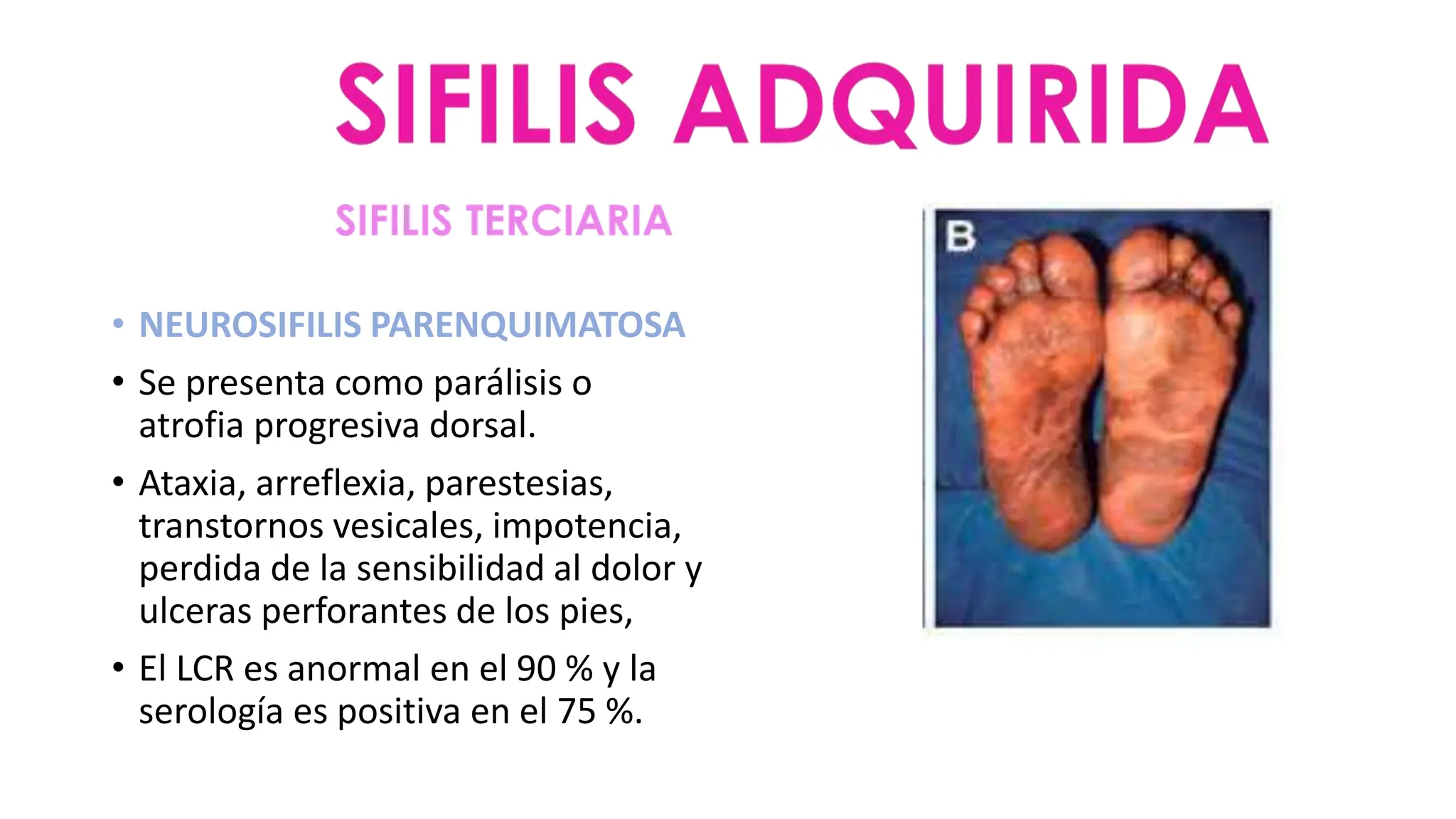 SIFILIS enfermedades de transmision sexual | PPT
