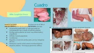 sifilis-congenita escenario II NEONATOLOGIA | PPTX
