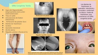 sifilis-congenita escenario II NEONATOLOGIA | PPTX