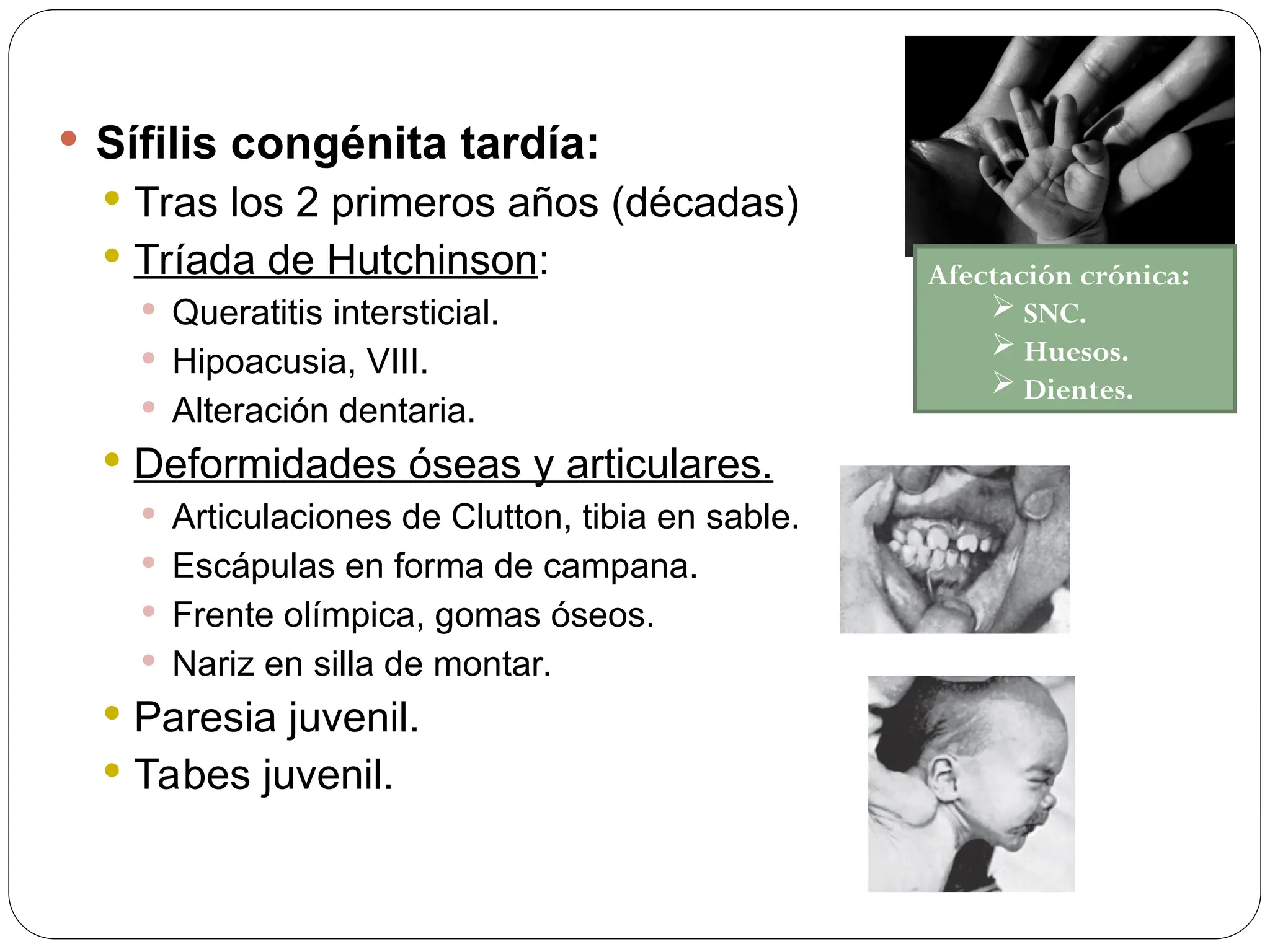 sifilis-congenita-maria-eugenia-guillot.ppt