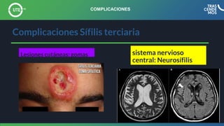 Sifilis (1).pptx