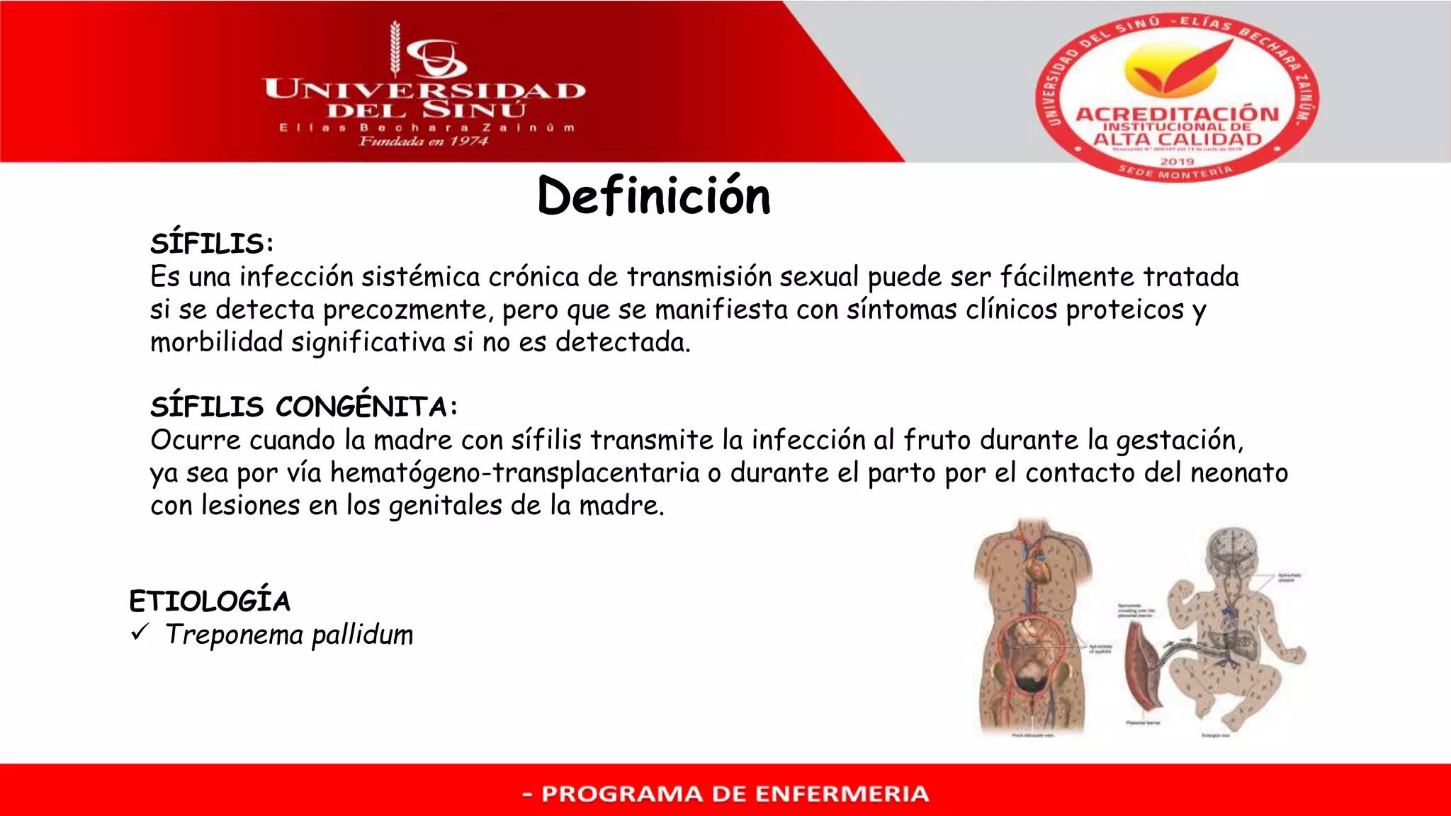 Sifilis congenita | PPTX