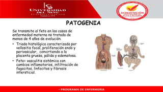 Sifilis congenita | PPTX