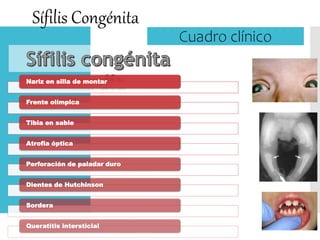 Sífilis congénita - Efectos y consecuencias en infantes | PPTX