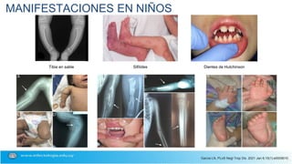 Sifilis_Congenita.pdf documento para estudiantes | PDF
