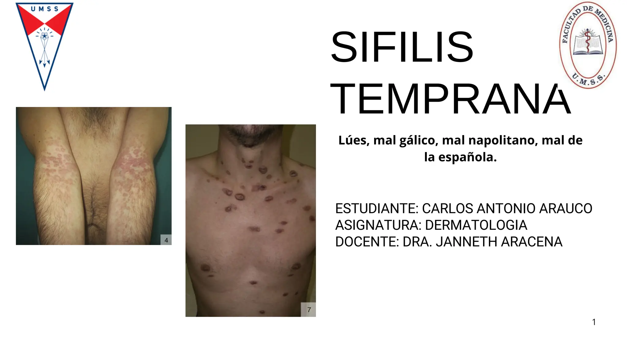 Sifilis Dermatologia Pdf Umss Quinto Año Pdf