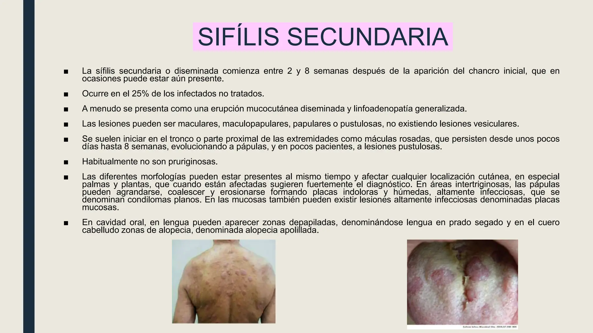 SIFILIS INTRODUCCION Y SUS DISTINTAS FORMAS DE CONTAGIO.pptx