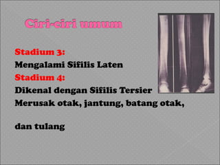 Sifilis presentation | PPT