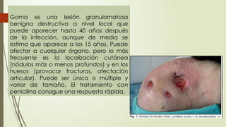 SIFILIS TRATAMIENTO Y CALSIFICACION DEFINICIONES | PPTX
