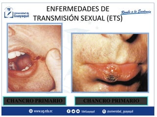 SIFILIS VENEREA Y CONGÉNITA.pdf