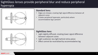 Ophthalmology Innovation Showcase 2 - SightGlass Vision | PPT