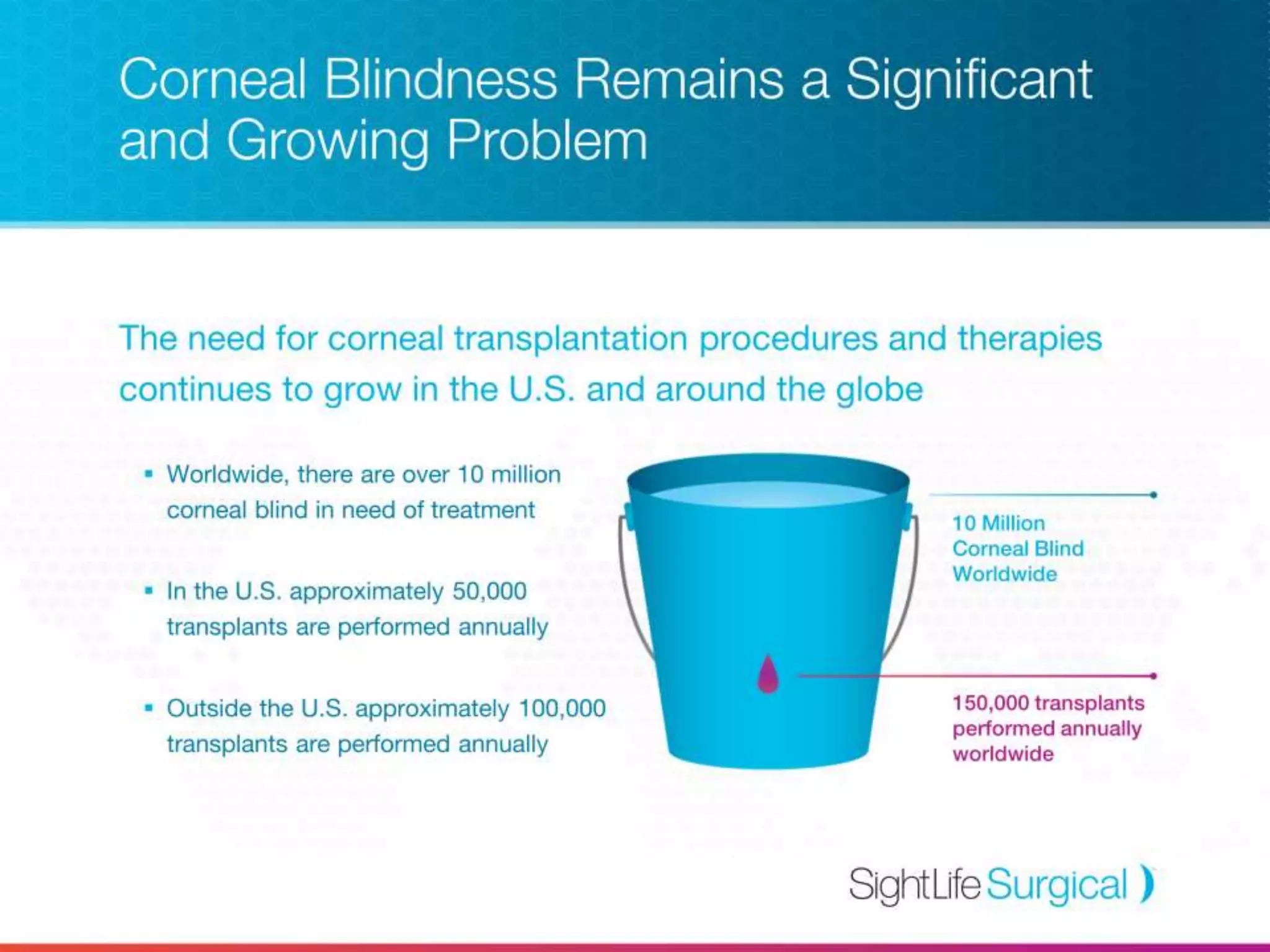 Anterior Segment Company Showcase - SightLife | PPTX