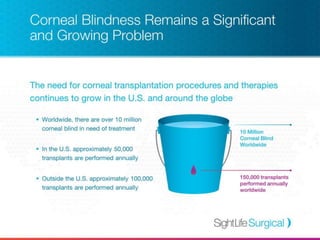 Anterior Segment Company Showcase - SightLife | PPTX