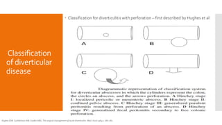 Sigmoid diverticular disease | PPTX