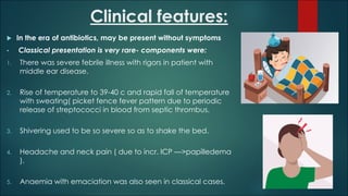 Sigmoid sinus thrombosis in otolaryngology | PDF