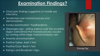 Sigmoid sinus thrombosis in otolaryngology | PDF